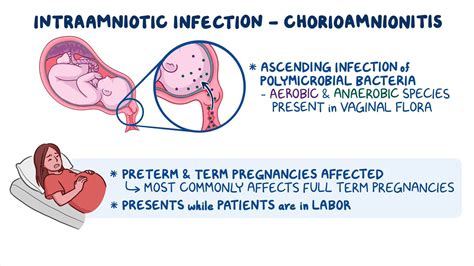 Chorioamnionitis
