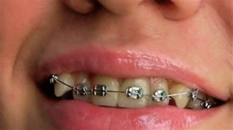 SEXY BRACKETS CLOSE UP Empire Of Passion And Dreams Clips Sale