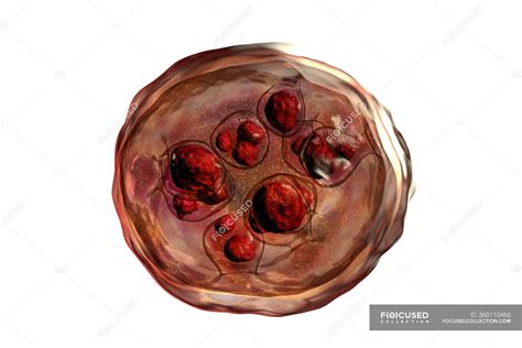 Echinococcus Granulosus Hydatid Cyst Computer Illustration — Disorder