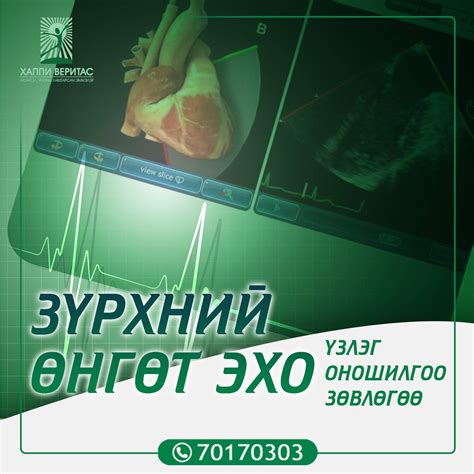 👩‍🔬Зүрхний ЭХО оношилгоо болон үзлэг зөвлөгөө хийж байна ☝️Зүрхний өнгөт доплер ЭХО оношилгоо