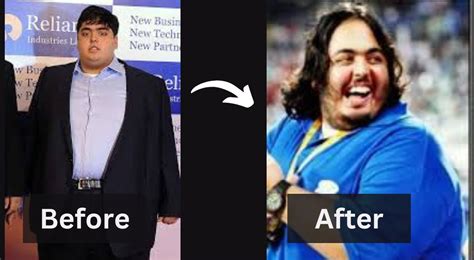 Anant Ambani Weight Loss Journey How He Lost Over 108 Kgs