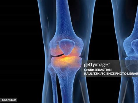Femur And Tibia Anatomy