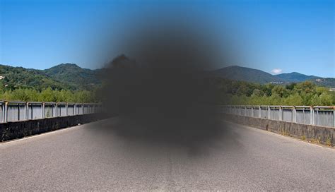 What Causes Age Related Macular Degeneration