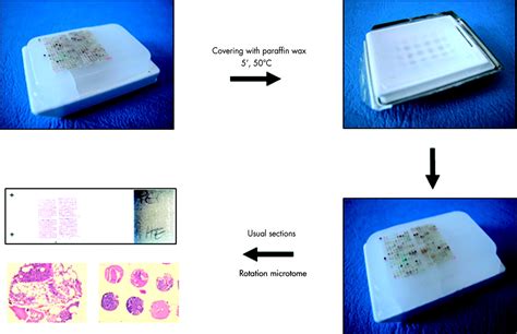 Demystified … Tissue Microarray Technology Molecular Pathology