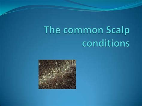 Scalp Conditions Ppt