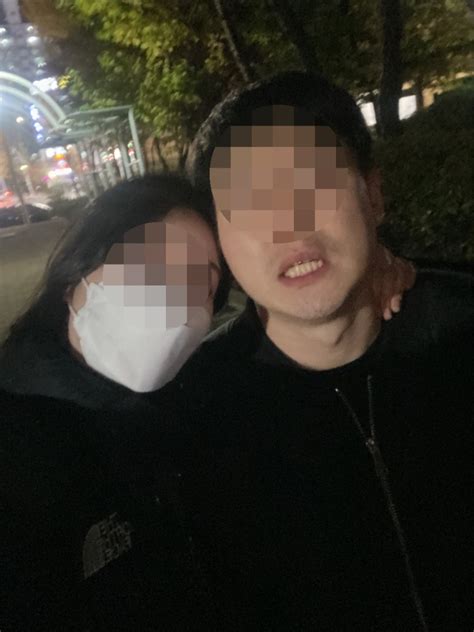 남자 수염 레이저 제모 5회차 후기 젠틀맥스프로 플러스 가격 비교 네이버 블로그