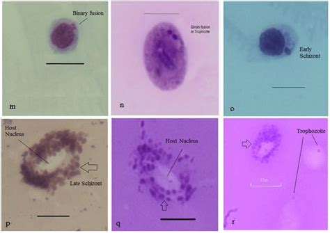 Infected Hemocytes At Different Stages Scale Bar 10µ × 100 May