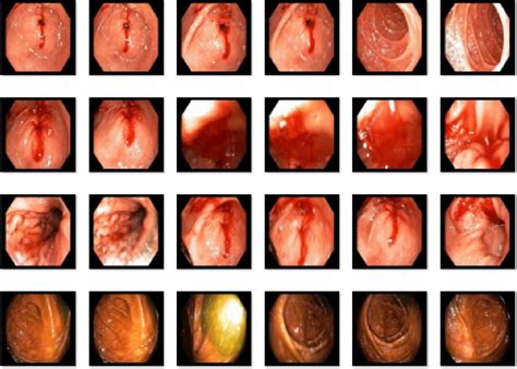 figure 3 from explainable information retrieval using deep learning for