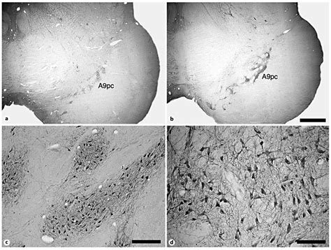 Photomicrographs Of The Clustered Organization Of The Pars Compacta