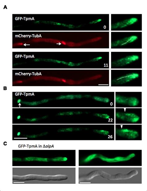 Actin Cable Formation In Mitosis Septum Formation Or Dalpa Strain