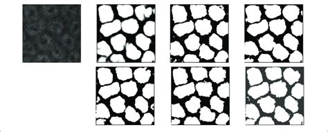 Segmentation Results For Mpm Dataset Row 1 Column 2 Unet Row 1