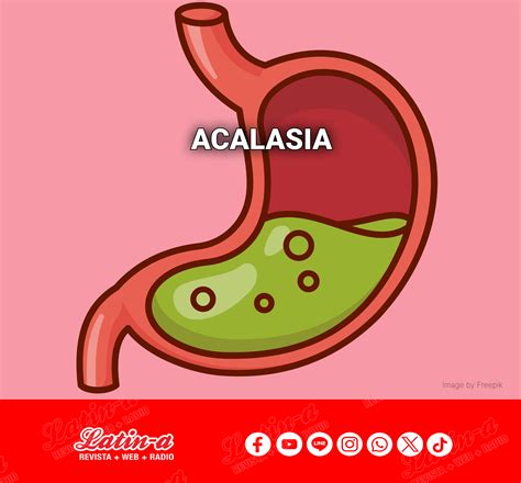 Acalasia Latin A Noticias De Japón