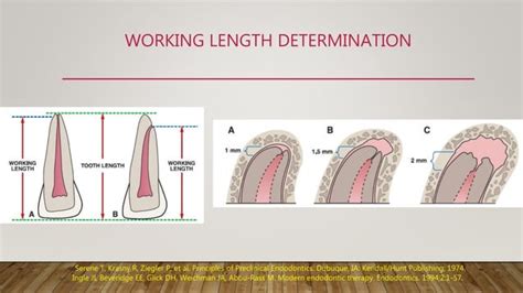 Structure Of Root Apex PPTX Dental Health Diseases And Conditions