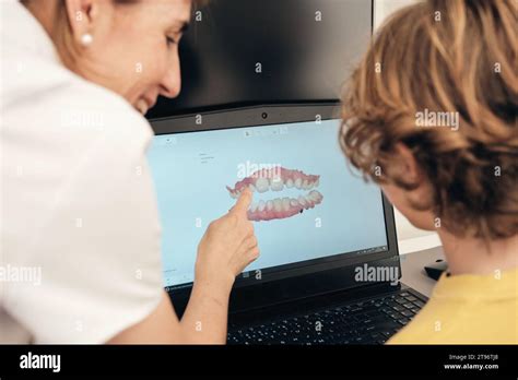 Crop Positive Female Dentist Demonstrating 3d Teeth Scan On Laptop To