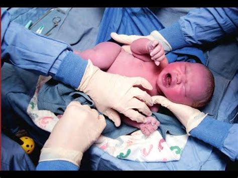 Neonatal Resuscitation Programe NRP 8th Edition And Case Scenario