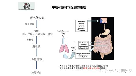 小肠细菌过度生长 Sibo）的诊断和治疗 知乎