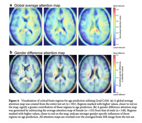 This Ai Analysis Unveils A Deep Convolutional Neural Community Cnn Mlp