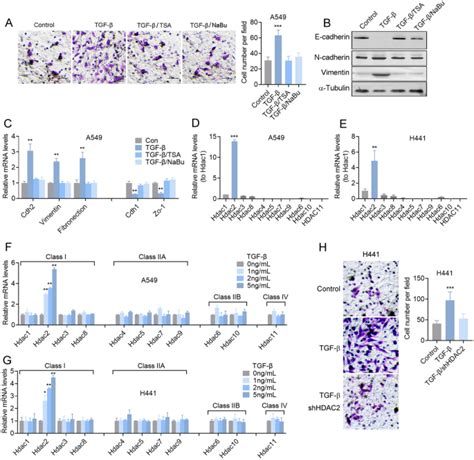 Correction Histone Deacetylase Inhibitors Inhibit Lung Adenocarcinoma