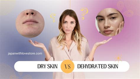 Dry Skin Vs Dehydrated Skin Know The Difference And Get Relief