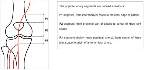 The Vascular Quality Initiative Assessment Of The Bard Lifestent For