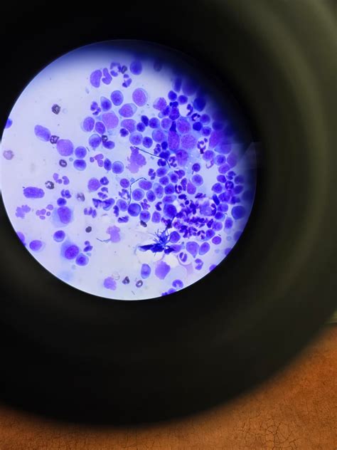 Skin Impression From A Toe Mass Rvettech