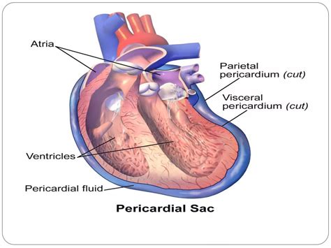 Pericardial Disease Ppt
