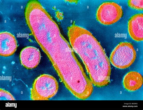 Tem Of Erysipelothrix Rhusiopathiae Species Of Bacteria Causing The