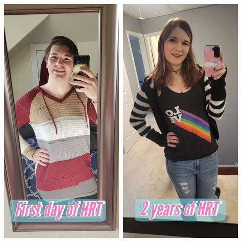 Today Marks 2yrs Of Hrt So Heres A Breast Growth Timeline As