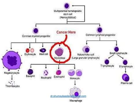Acute Myeloid Leukemia Neoplastic Diseasepptx