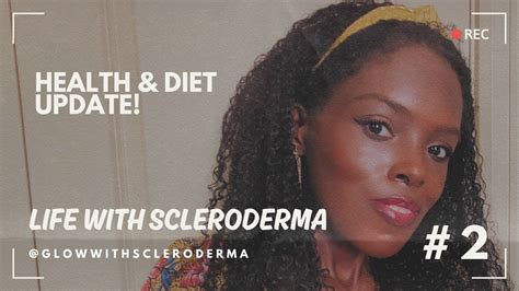 Diet And Health Update Glow With Scleroderma Vlog Youtube