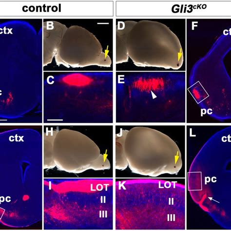 Innervation Of The Piriform Cortex Is Disorganized In P Gli CKO Download Scientific Diagram