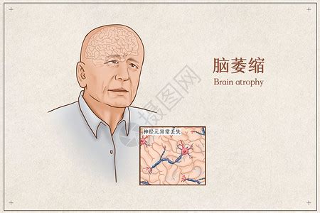 世界帕金森日扁平风格插画设计插画图片下载 正版图片402734813 摄图网