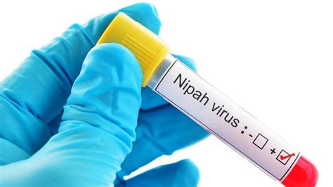No New Positive Case Of Nipah 61 Negative Results Kerala Govt India