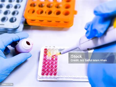 의료 실험실에서 마이크로플레이트를 다루는 과학자 실험실에서 면역학적 분석을 위해 Elisa를 수행하는 연구원 Stem 주제에