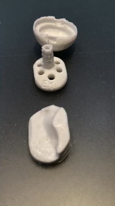 Bruno Gobbato On Linkedin Augmented Glenoid Baseplate For Reverse