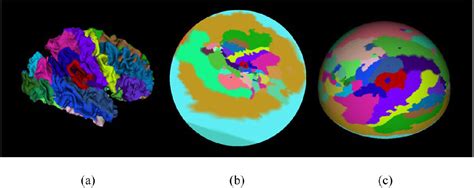 Figure 1 From Least Square Conformal Brain Mapping With Spring Energy