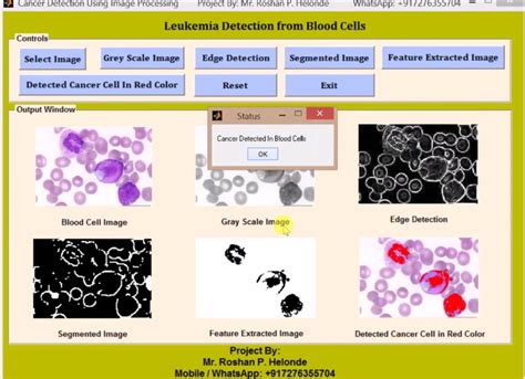 leukemia detection using image processing matlab project source code