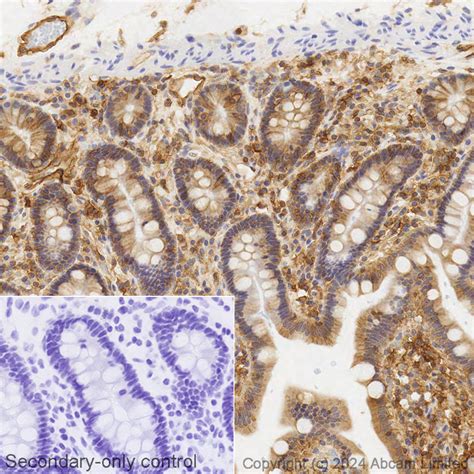Avidinbiotin Blocking Kit 15 Ml Ab64212 Abcam