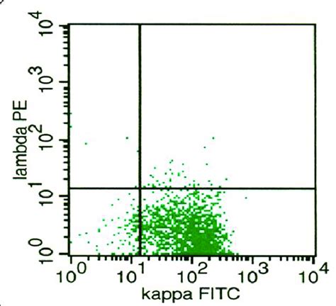 Flow Cytometry Diagram Showing Ä¸lightÄ¸light Chain Restriction Download Scientific Diagram