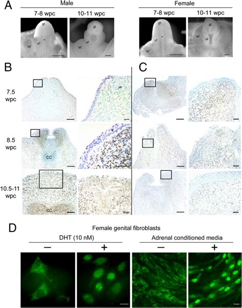 Alternative Pathway Androgen Biosynthesis And Human Fetal Female Virilization Abstract