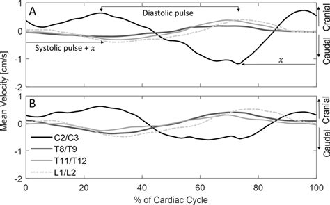 Mean Velocity Waveforms N 9 Over One Cardiac Cycle For Four Spinal