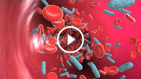 Sepsis Information On Causes Symptoms Types And Treatment Megabazanet