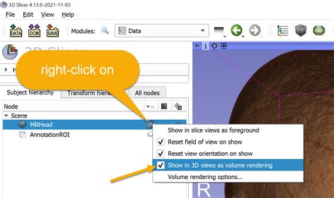 Removing 3d Model To View Segmentation Support 3d Slicer Community