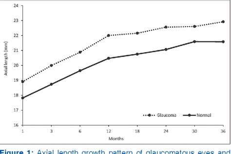 Figure 1 From Comparison Between Ocular Biometry Parameters In Patients With Unilateral