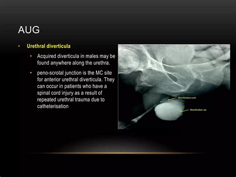 Ascending Urethrogram Pptx