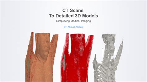 Ct Scans To Detailed 3d Models Simplifying Medical Imaging