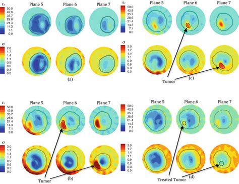 Theoretical Premises And Contemporary Optimizations Of Microwave