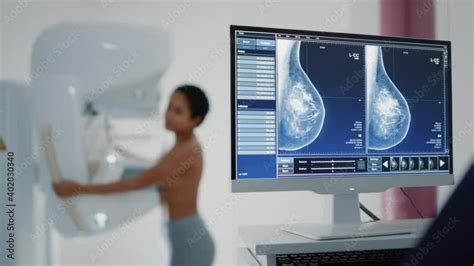 Computer Screen In Hospital Radiology Room Beautiful Multiethnic Young