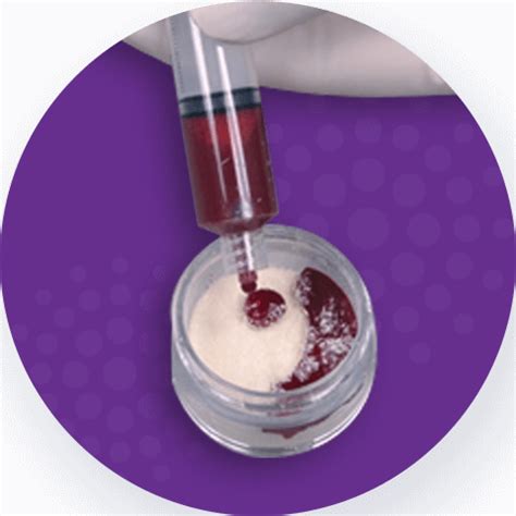 Actigen™ Verified Inductive Bone Matrix Sanara Medtech Naturally