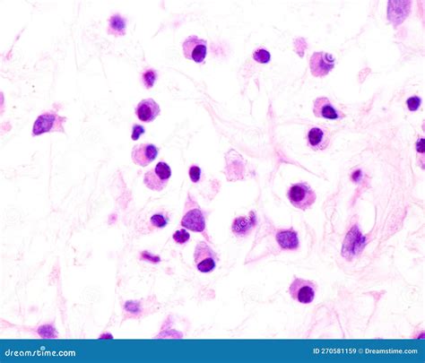 Plasma Cells Vs Lymphocytes
